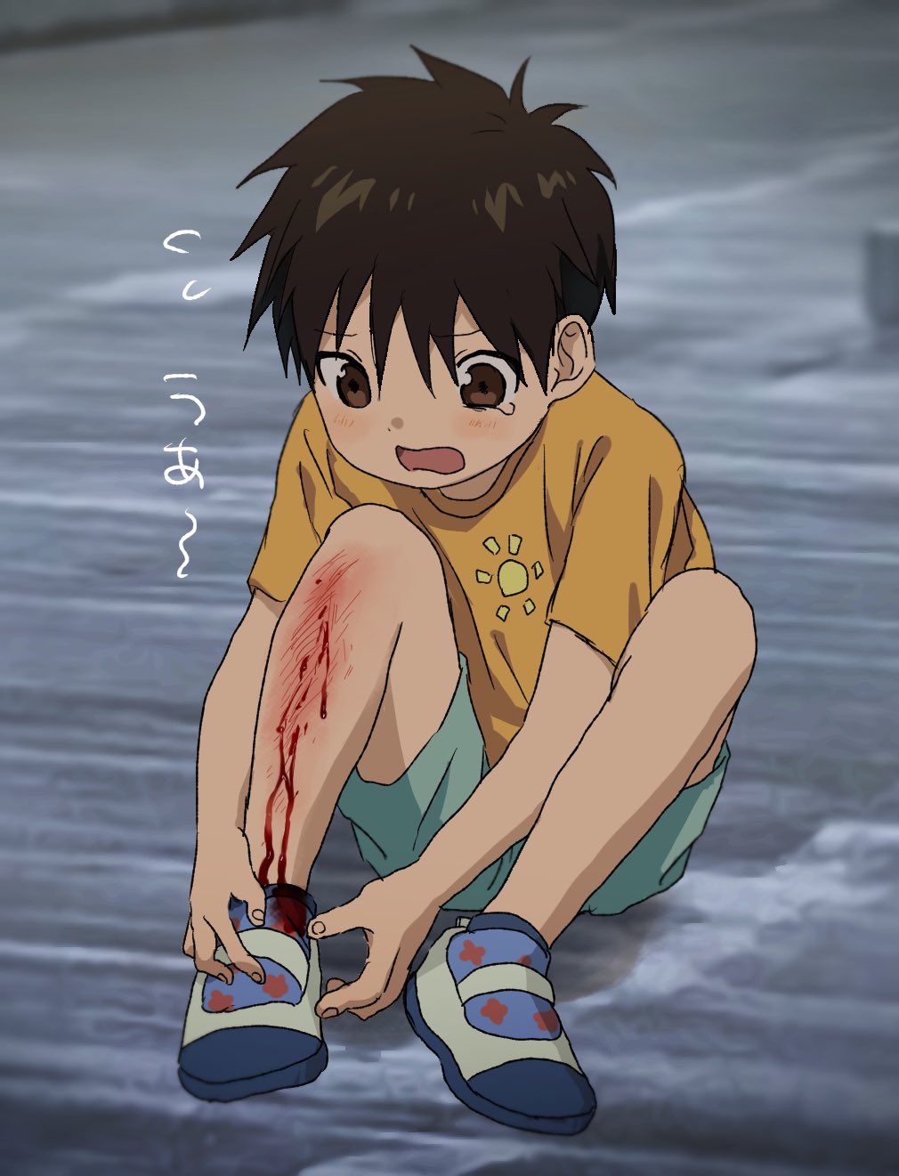 Safebooru - 1boy bleeding blood bruise child commentary request cuts ...