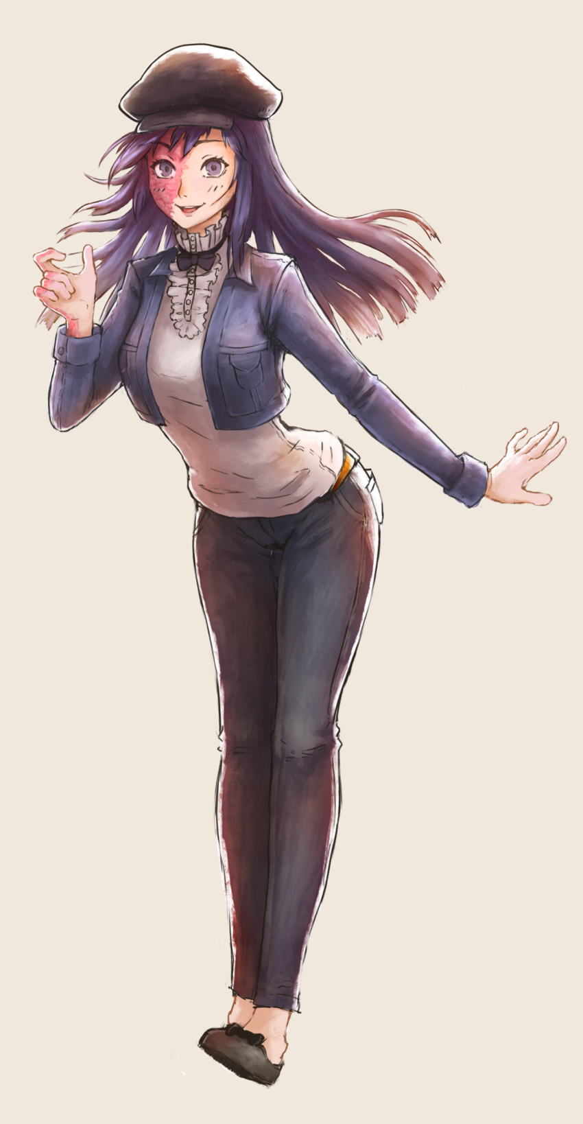 Safebooru - 1girl :d absurdres bow footwear burn scar casual commentary ...